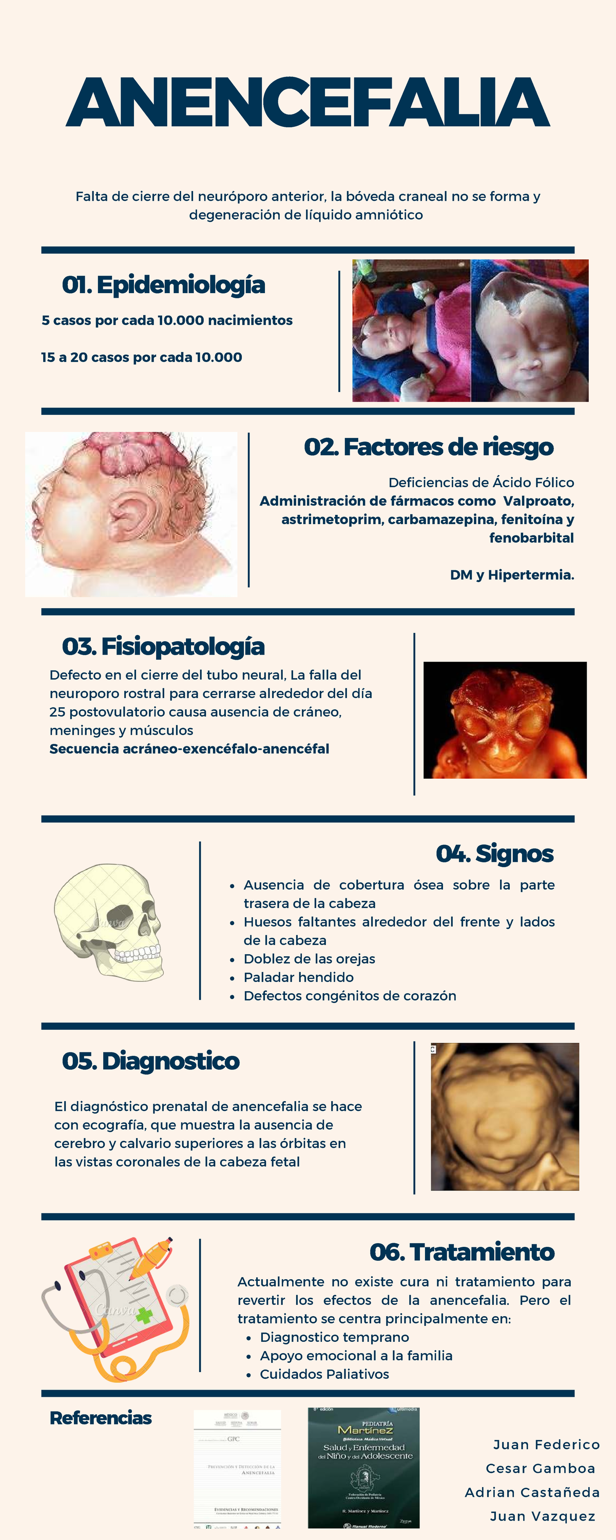 Anencefalia: epidemiología, diagnóstico y tratamiento (Pediaboys) - Studocu