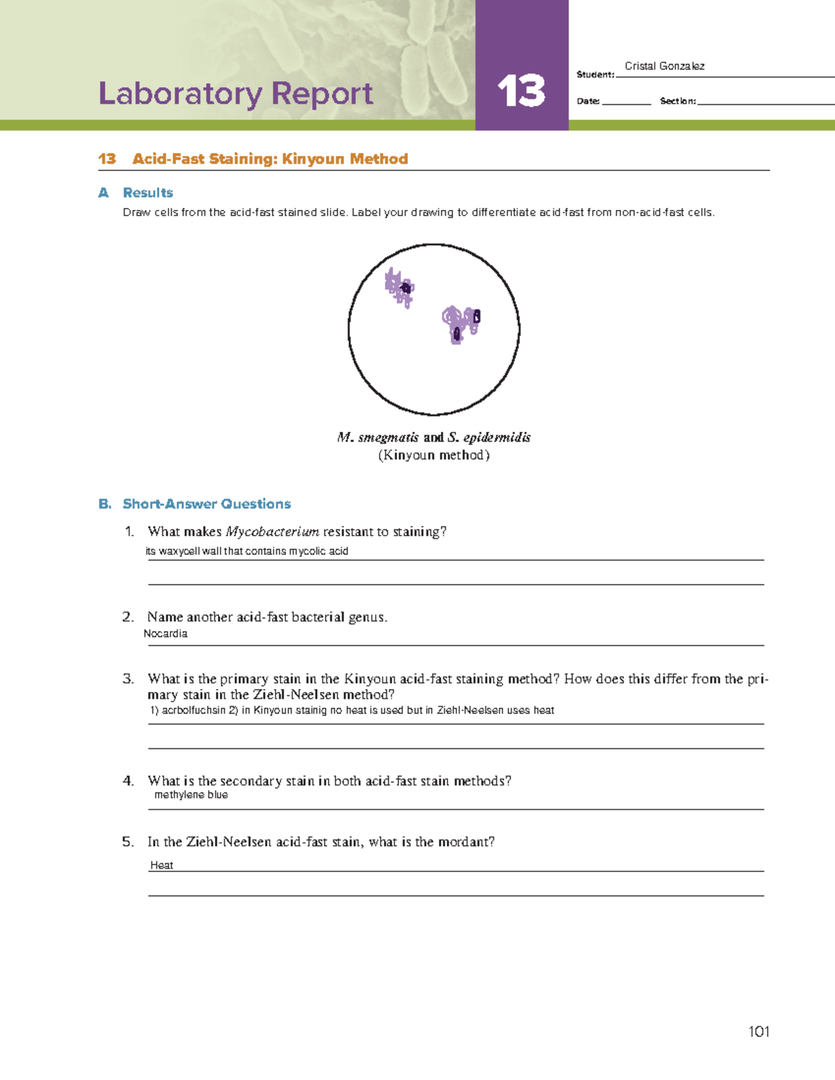 Lab Report: Exercise 13 - Acid-Fast Staining (Kinyoun Method) - Studocu