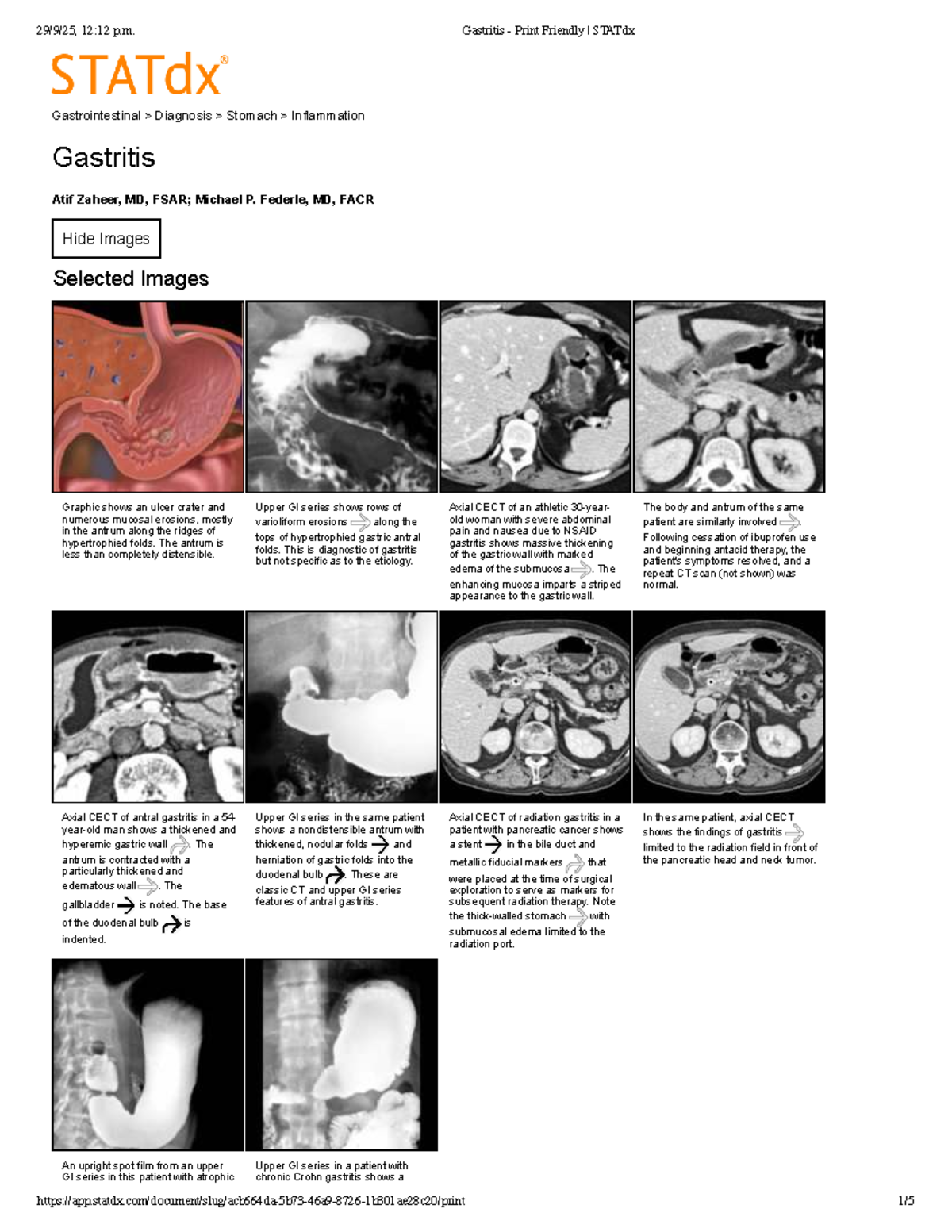 Gastrointestinal Diagnosis: Gastritis Overview - STATdx - Studocu