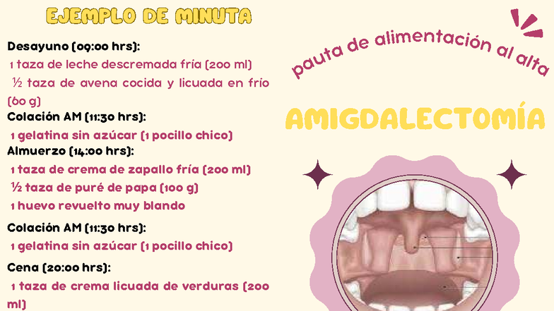 Plan de Alimentación Post Amigdalectomía - Studocu