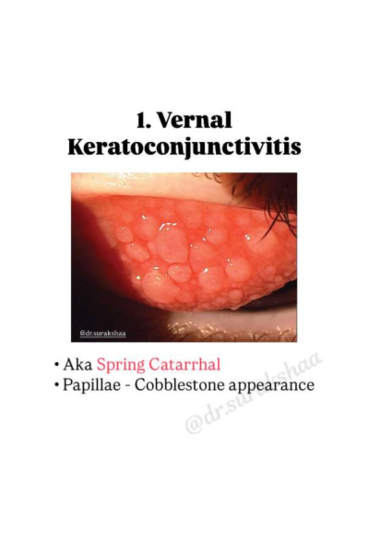 Ophthal Images: Key Conditions & Findings in Eye Disorders - Studocu
