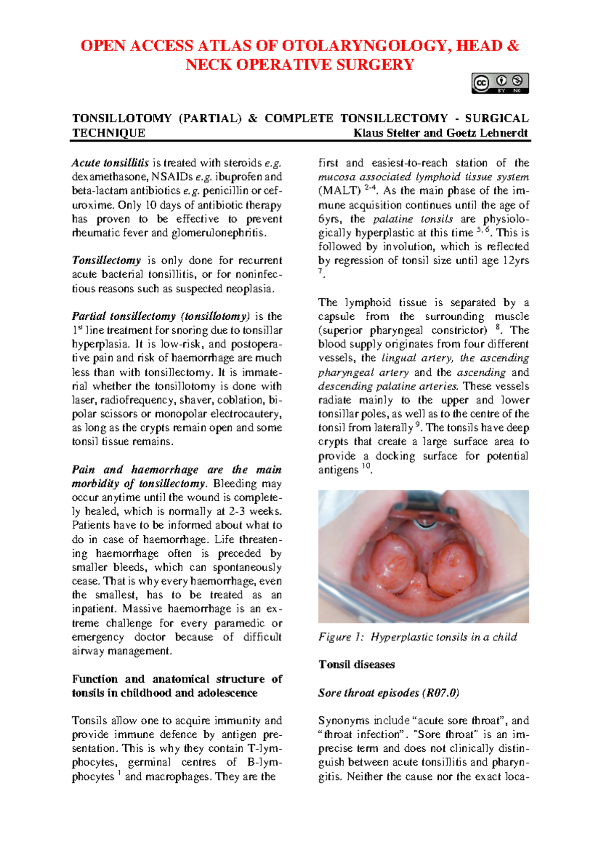 Tonsillotomy and Complete Tonsillectomy Surgical Techniques (ENT 101 ...