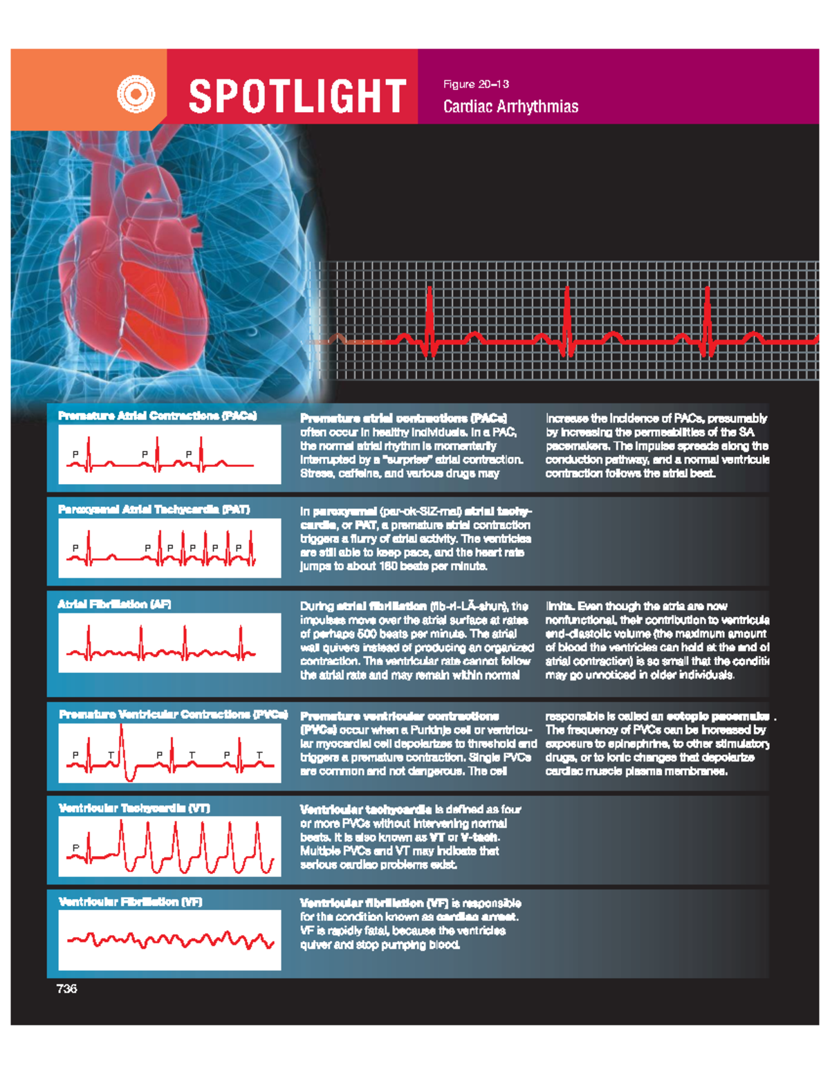 M20_Cardiac_Arrhythmias_and_Heart_Function_Study_Notes - Studocu