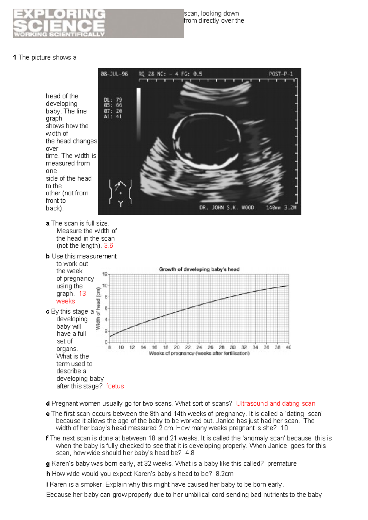 Worksheet 1 - Understanding Foetal Development in Pregnancy - Studocu