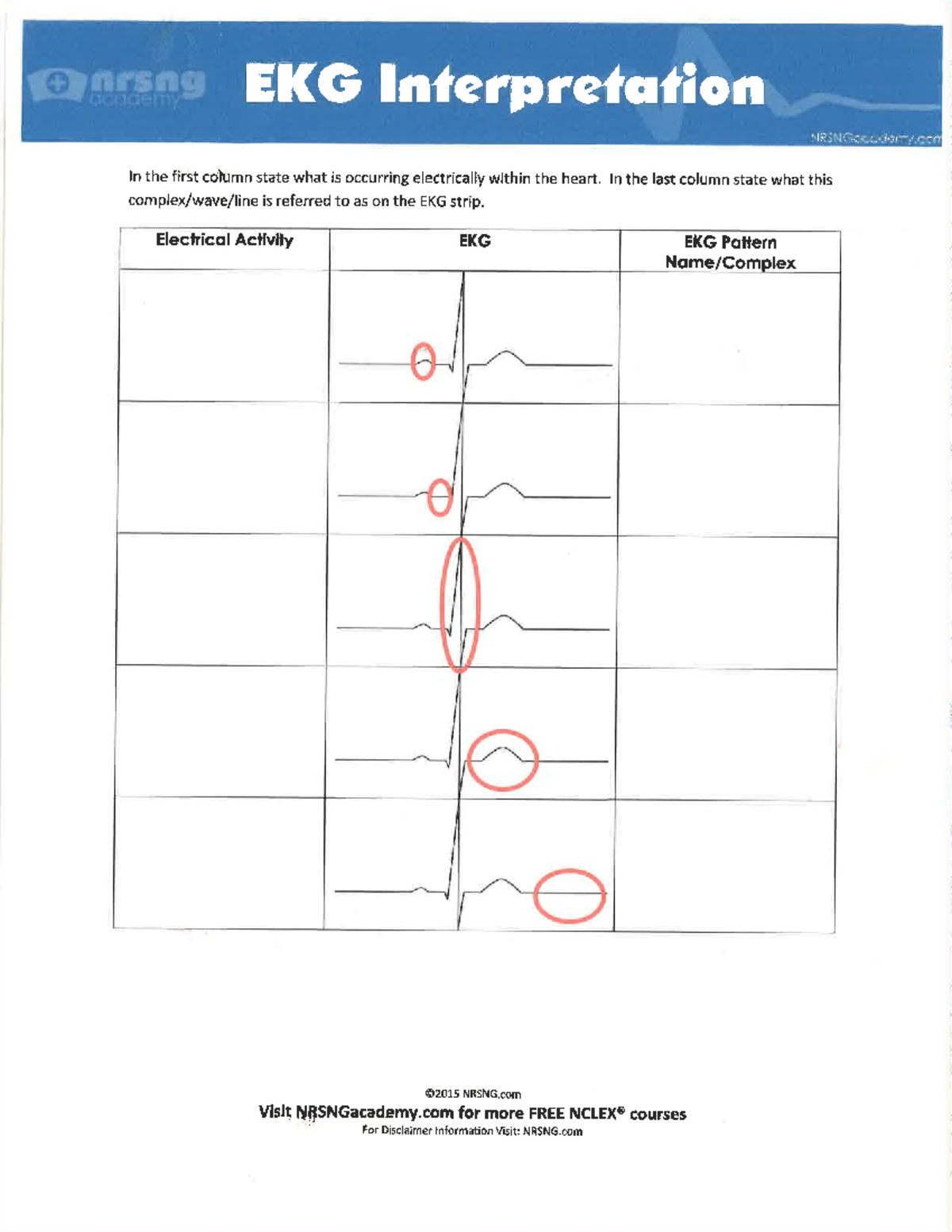 EKG Interpretation Notes for NRSNG Academy - Key Patterns & Activity ...