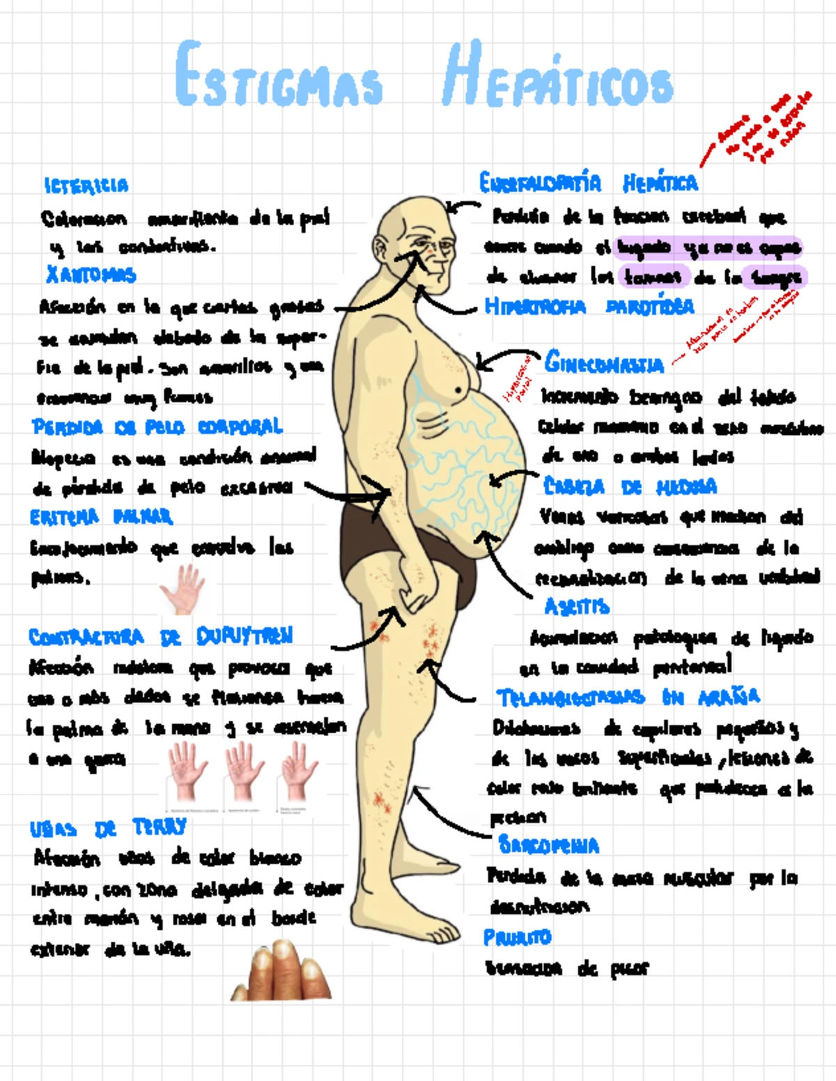 Tratamiento Antirretroviral del VIH: Esquemas y Consideraciones ENARM ...