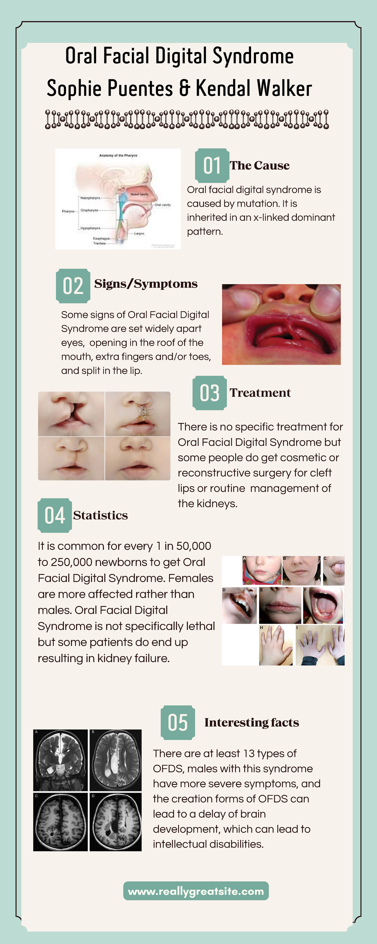 Syndrome Oral Facial Digital