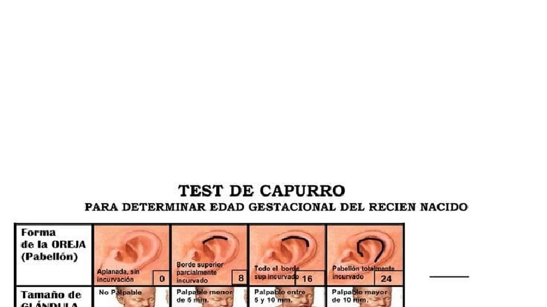 TEST DE CAPURRO PARA DETERMINAR EDAD GESTACIONAL DEL RECIÉN NACIDO ...