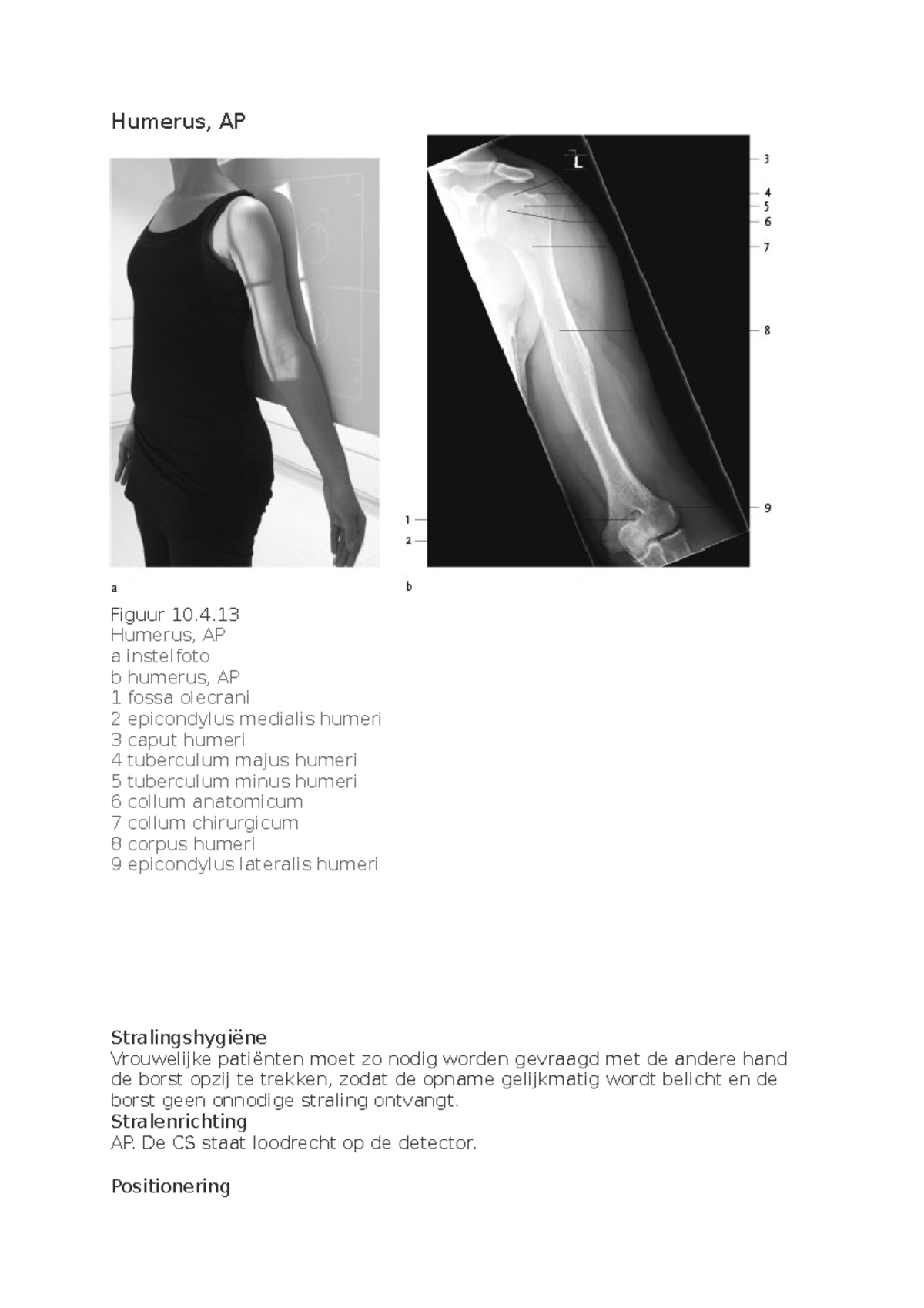Humerus Imaging Protocol: AP and Lateral Views Guidance - Studeersnel
