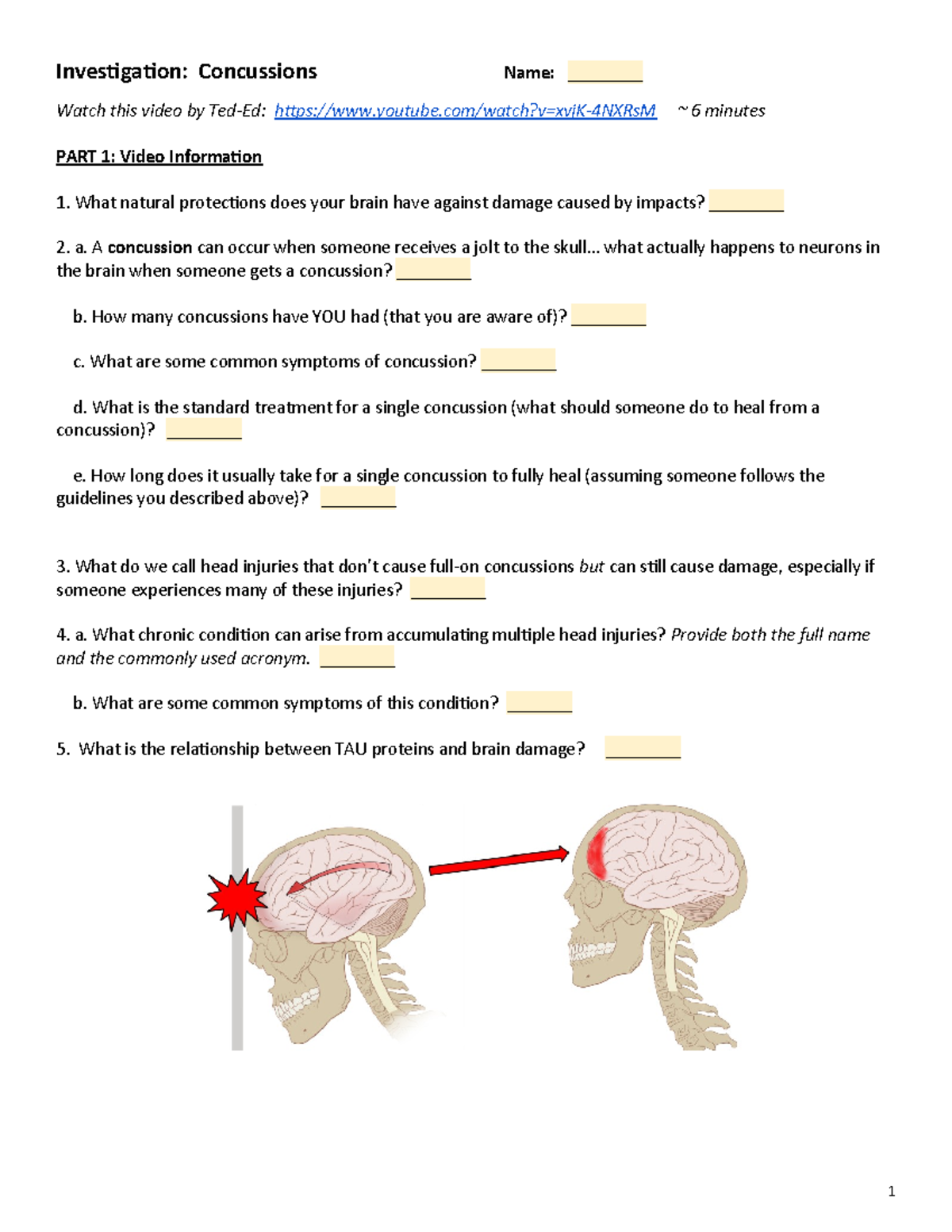 Investigation Concussions - What natural protections does your brain ...