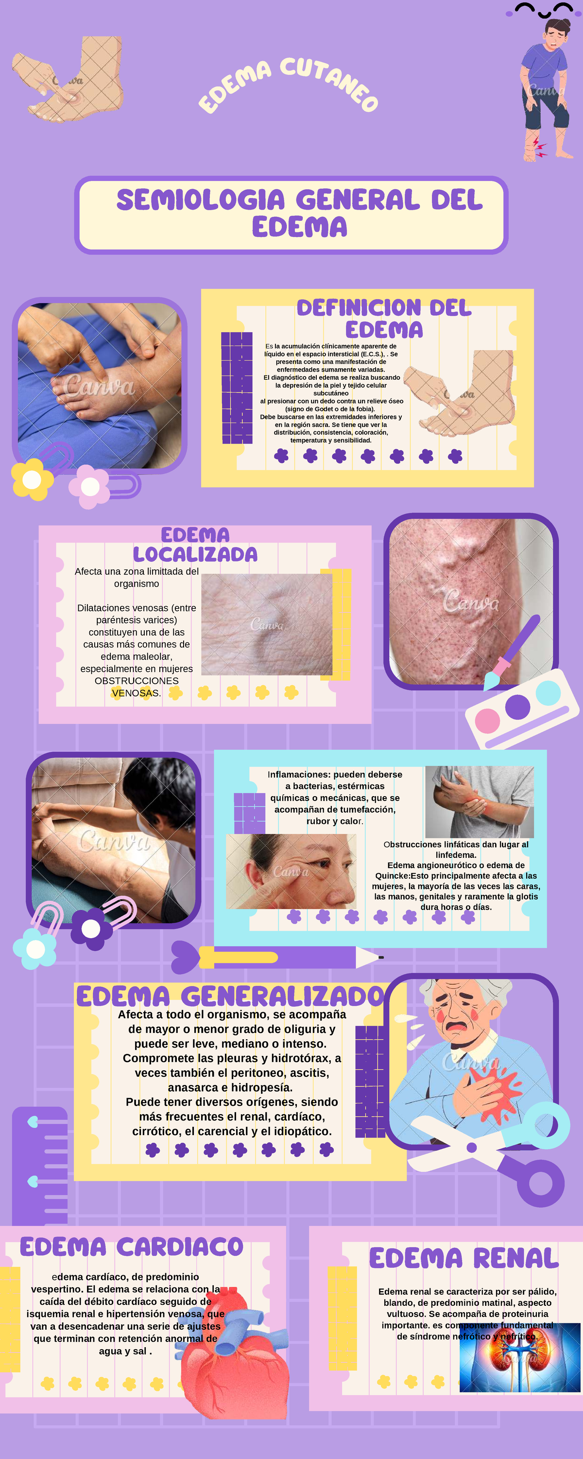 Infografía sobre Edema: Definición y Tipos (E.O.C.U.T.A.) - Studocu