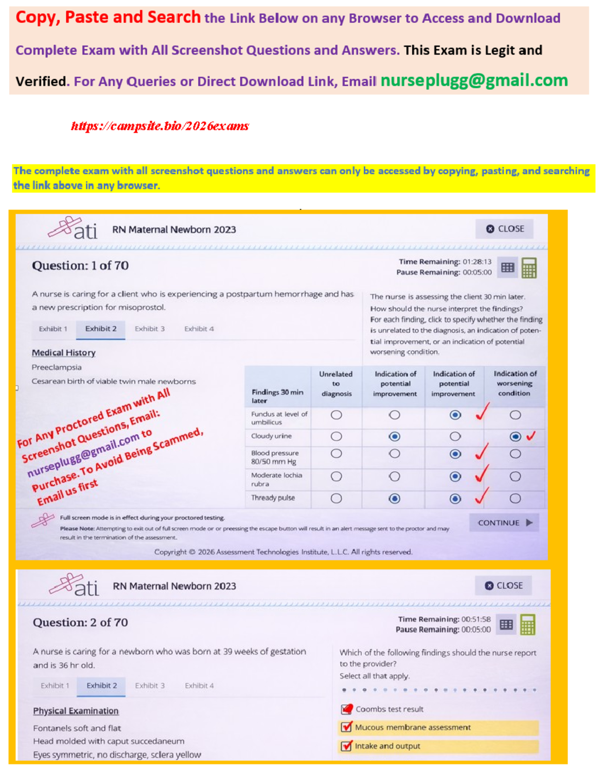 Crush ATI RN Maternal Newborn 2023-2026 Proctored Exam NGN Guide - Studocu