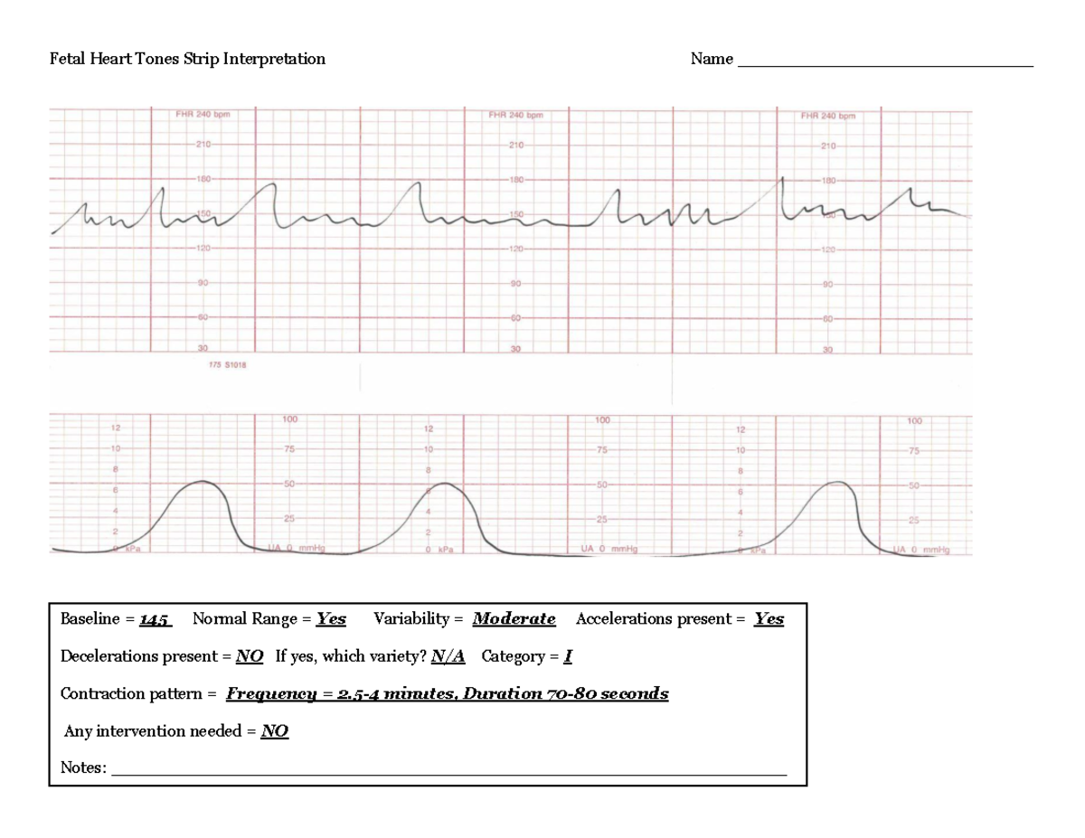 Fetal Heart Tones Strip Interpretation - Answer Key for Assessment ...