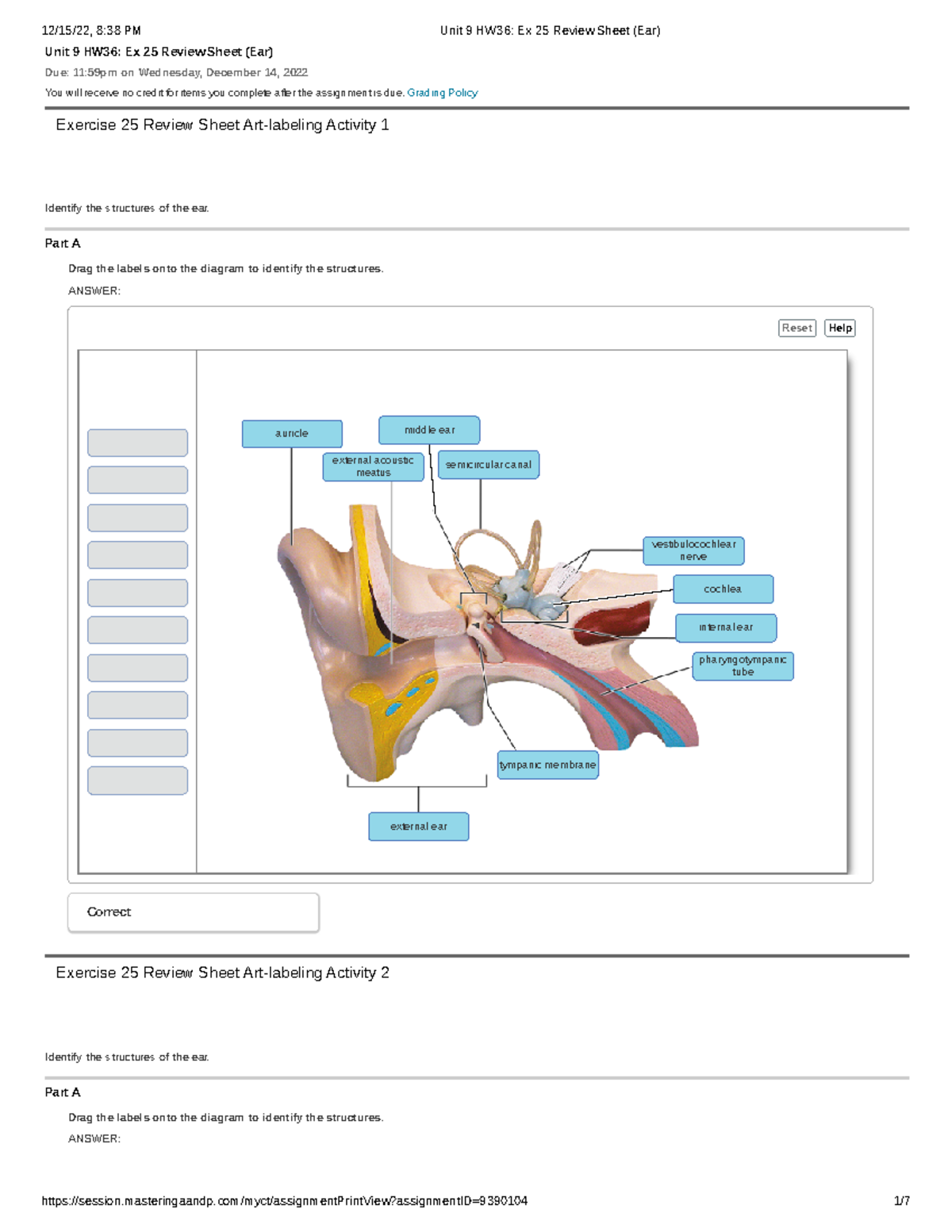 Unit 9 HW36 Exercise 25 Ear Anatomy Review Sheet - Studocu