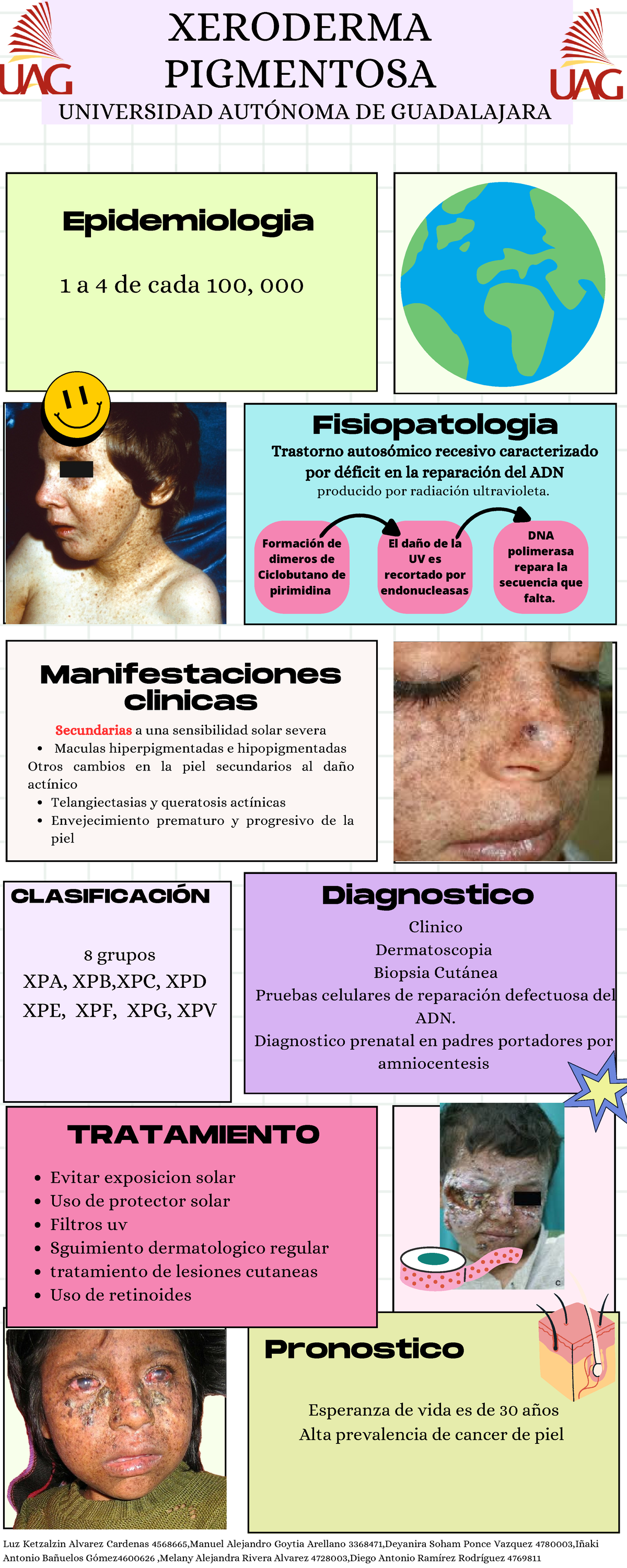 Infografía sobre Xerodermia Pigmentosa y sus Implicaciones Clínicas ...