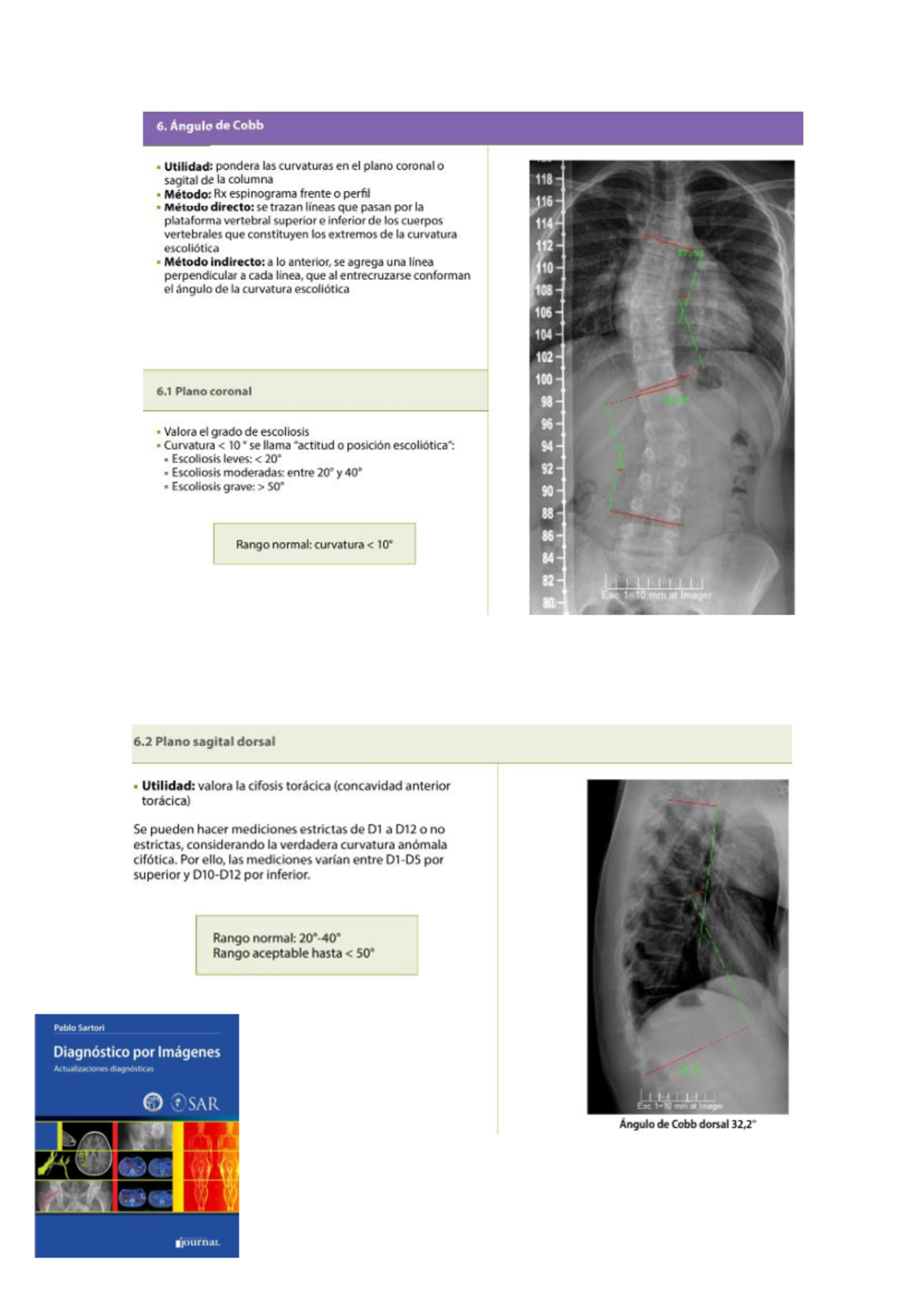 Mediciones Espino y MMII: Análisis del Ángulo de Cobb y Risser - Studocu