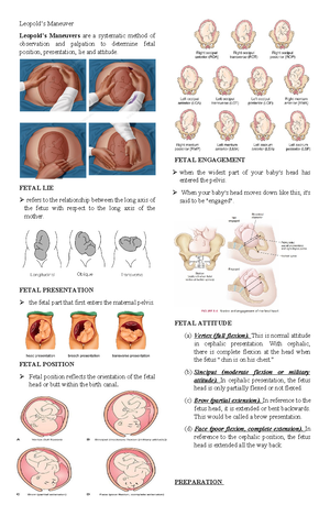 NSD G1 - A case study about normal spontaneous delivery - A case study ...