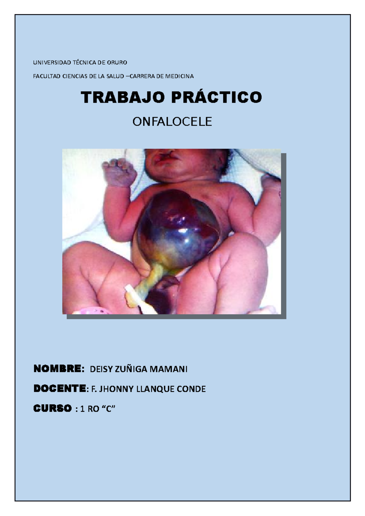 Onfalocele - EMBRIOLOGIA - UNIVERSIDAD TÉCNICA DE ORURO FACULTAD ...