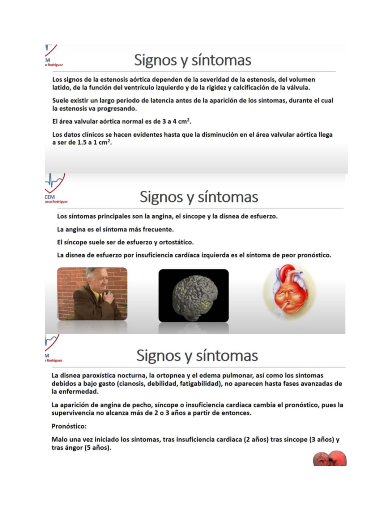 Signos Cardio: Angina, Disnea y Fisiopatología - Materia - Studocu