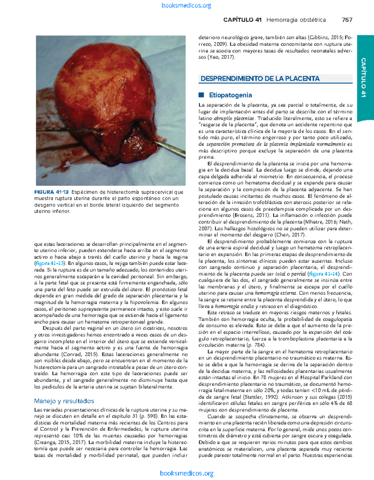 DPPN y Placenta Previa: Complicaciones y Manejo Obstétrico - Studocu