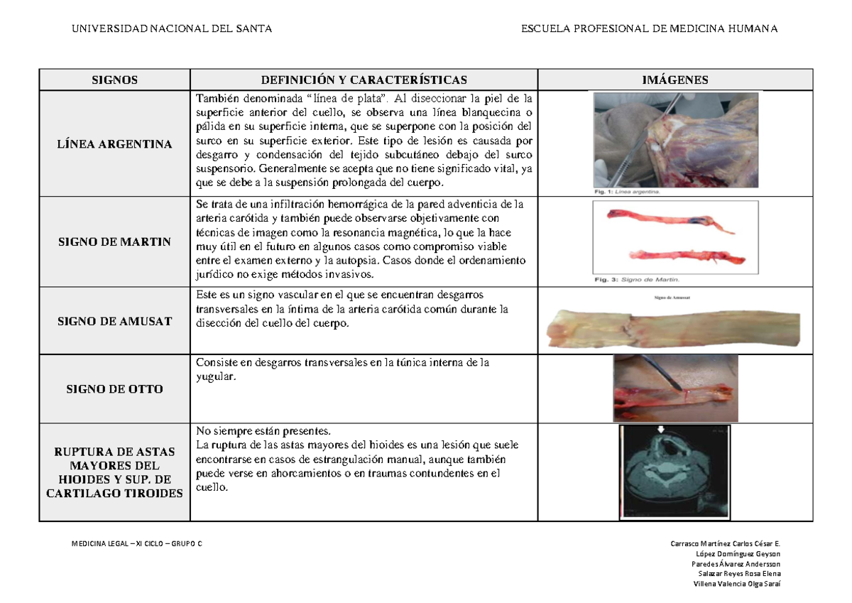 Signos de Estrangulación en Medicina Legal - XI Ciclo, Grupo C - Studocu