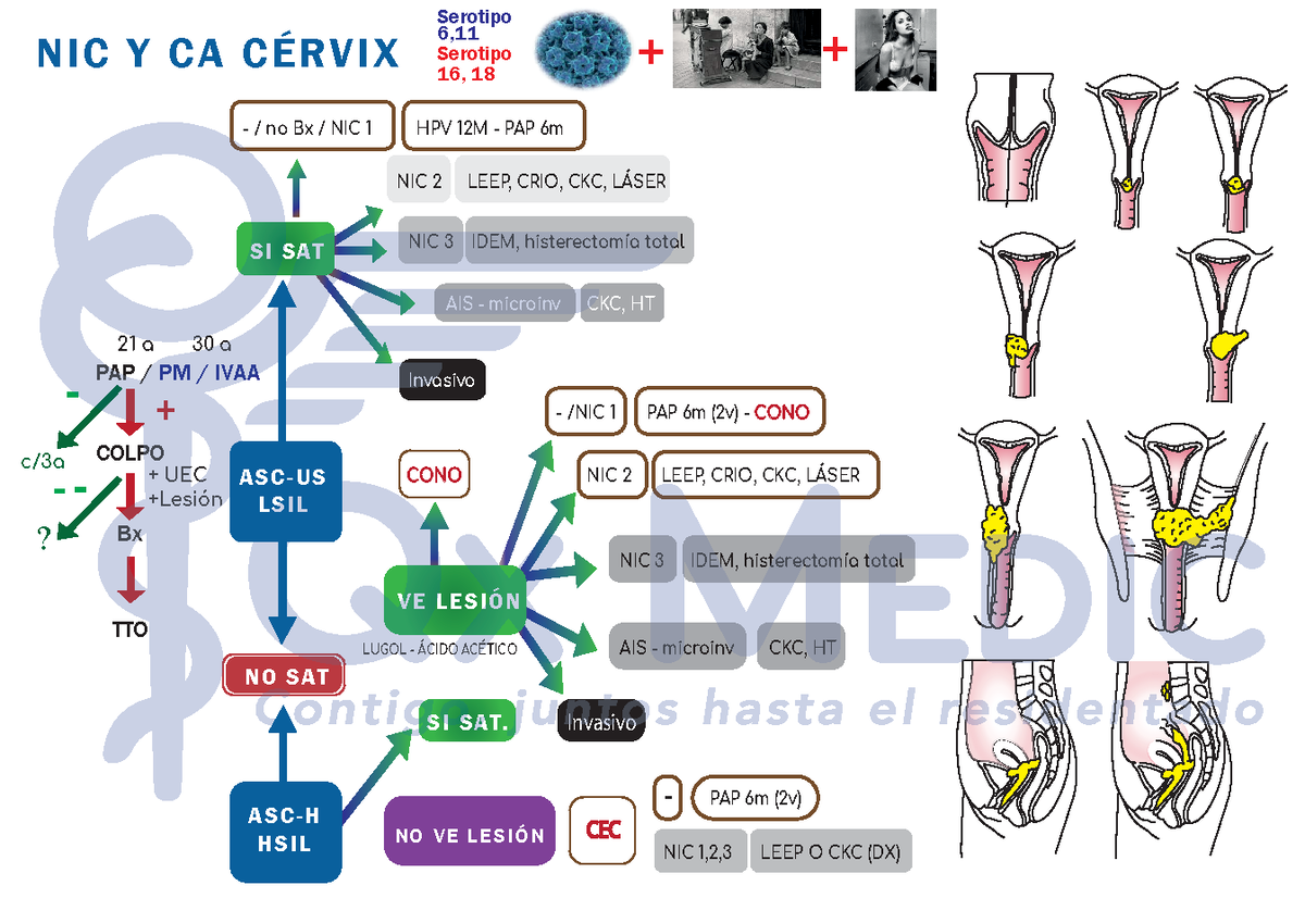 Cáncer DE Cervix - CANCER - / no Bx / NIC 1 NIC 2 NIC 3 AIS - microinv ...