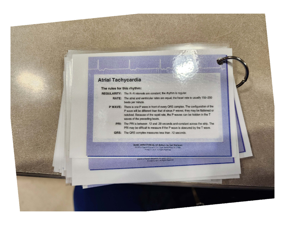 Cardiac Rhythms: Atrial Tachycardia Rules and Characteristics Analysis ...