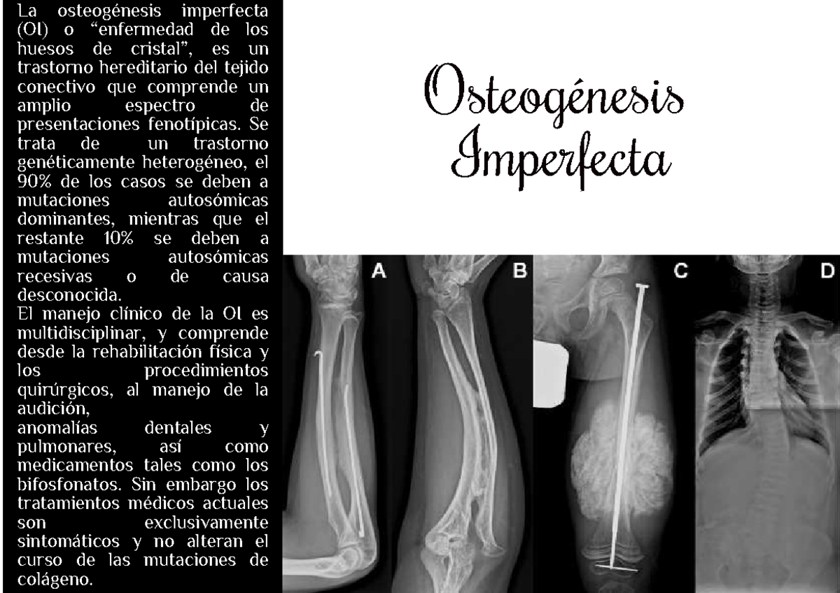 Osteogénesis Imperfecta: Características y Manejo Clínico - Studocu