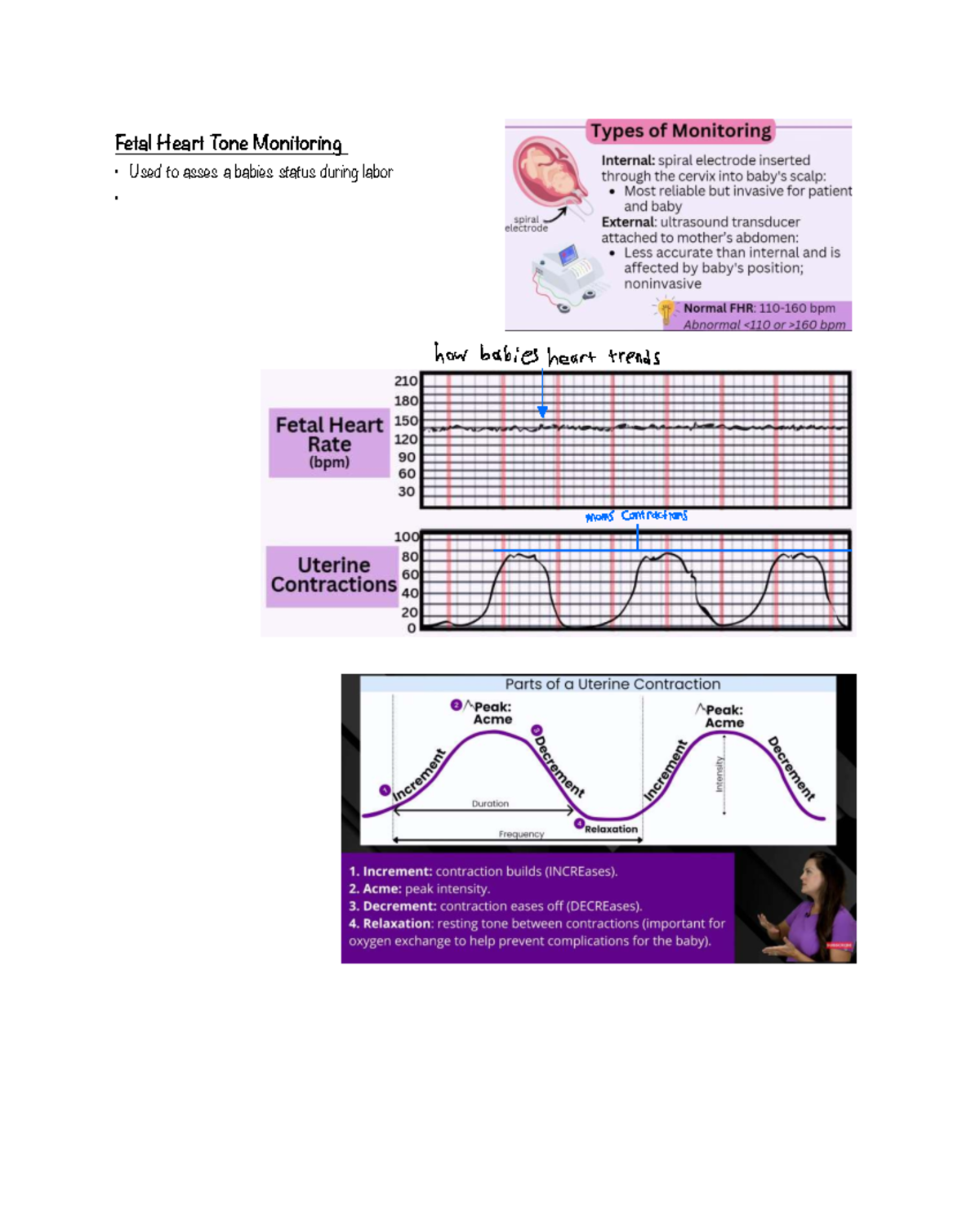 Fetal Heart Rate Monitoring: Understanding VEAL CHOP Patterns - Studocu