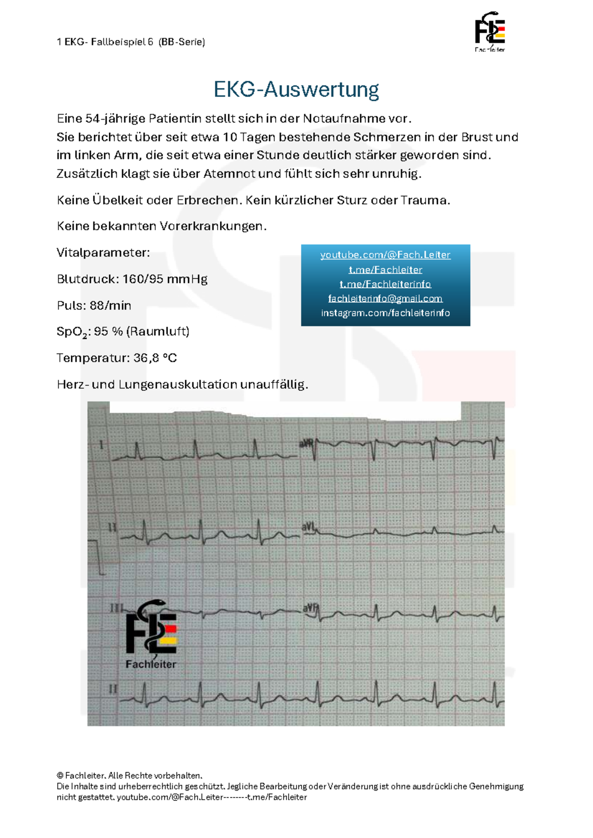 EKG-Fall 6: Patientin mit Thoraxschmerzen und Notaufnahme-Details - Studocu