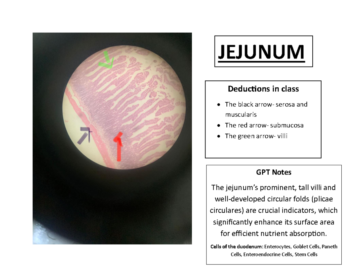 Histology slides, cmda 210 - JEJUNUM Deductions in class • The black ...