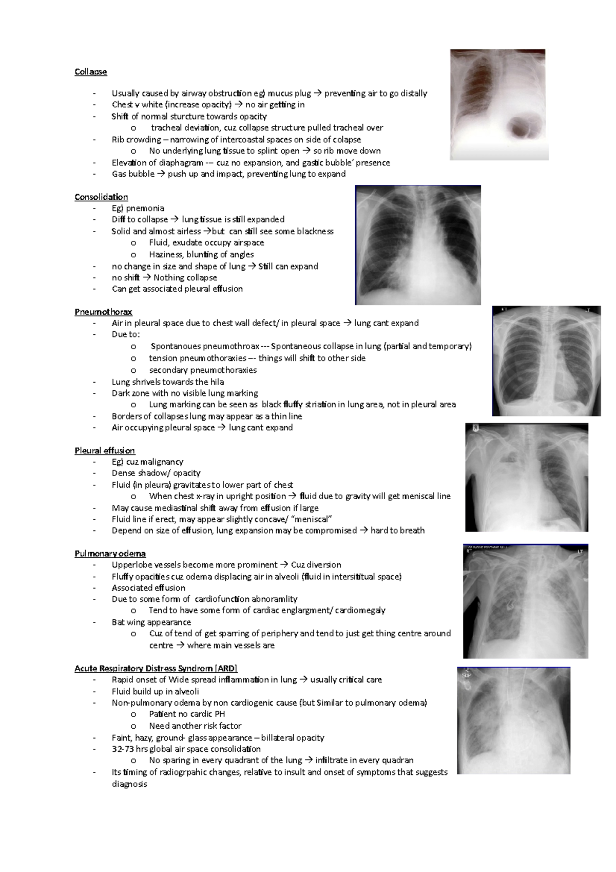 Chest X-Ray Pathologies Overview: Key Conditions and Features - Studocu