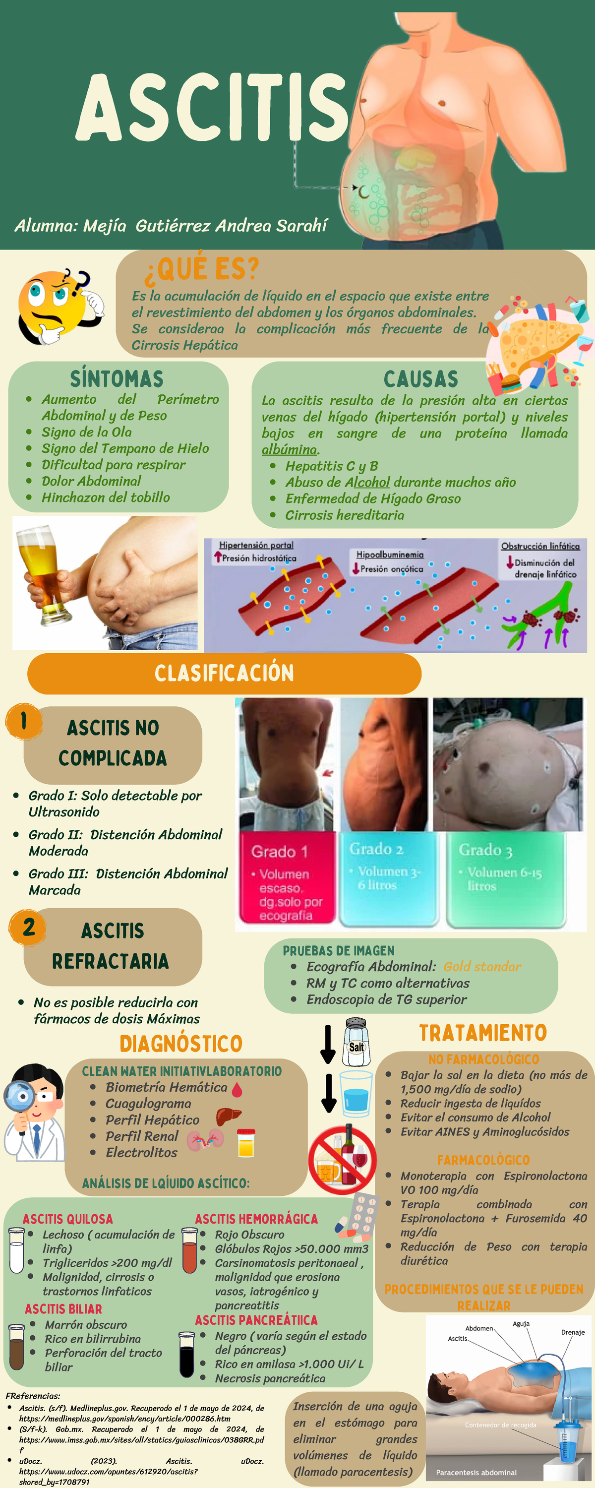 Infografía sobre Ascitis: Tipos, Diagnóstico y Tratamiento - Studocu