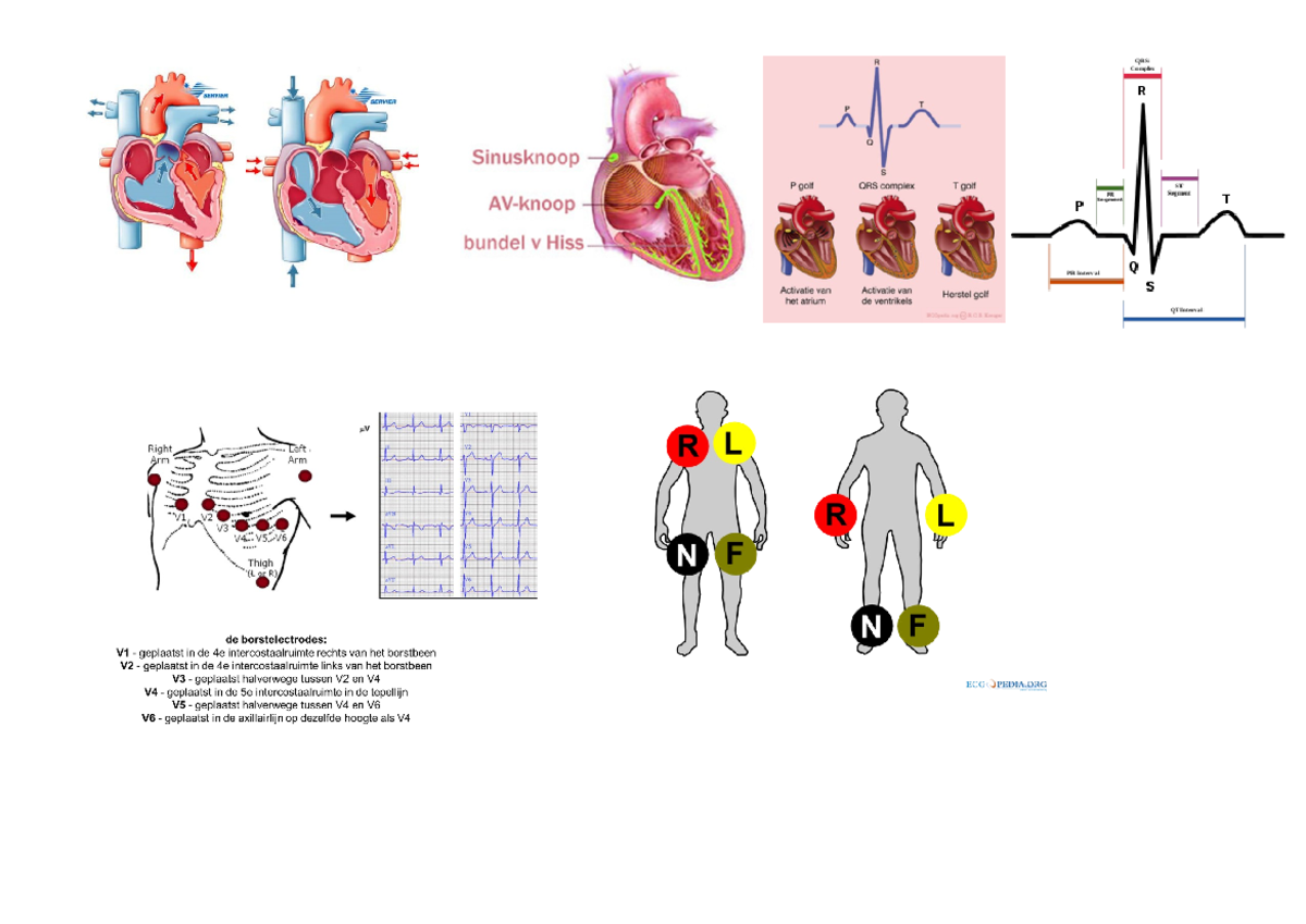 Samenvatting ECG - Ecg's interpreteren - SYSTEMATISCHE BEOORDELING VAN ...