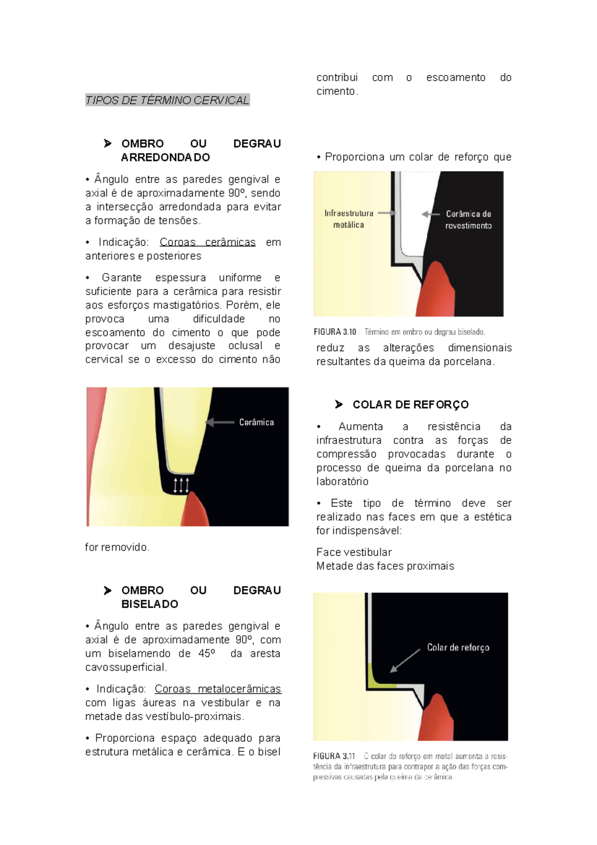 Tipos de Término Cervical em Prótese Dentária: Guia Completo - Studocu