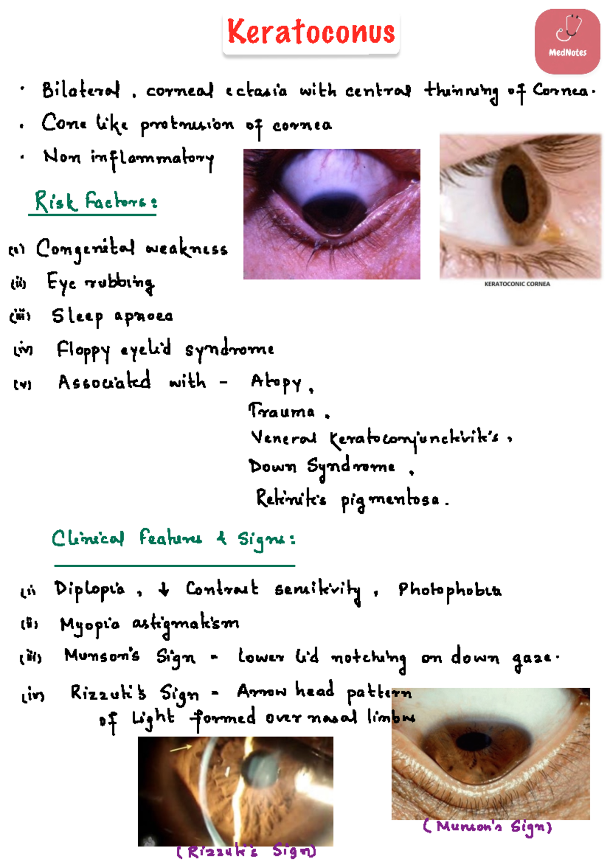 Keratoconus Overview - Summary from Med Notes (Course Code: 3) - Studocu