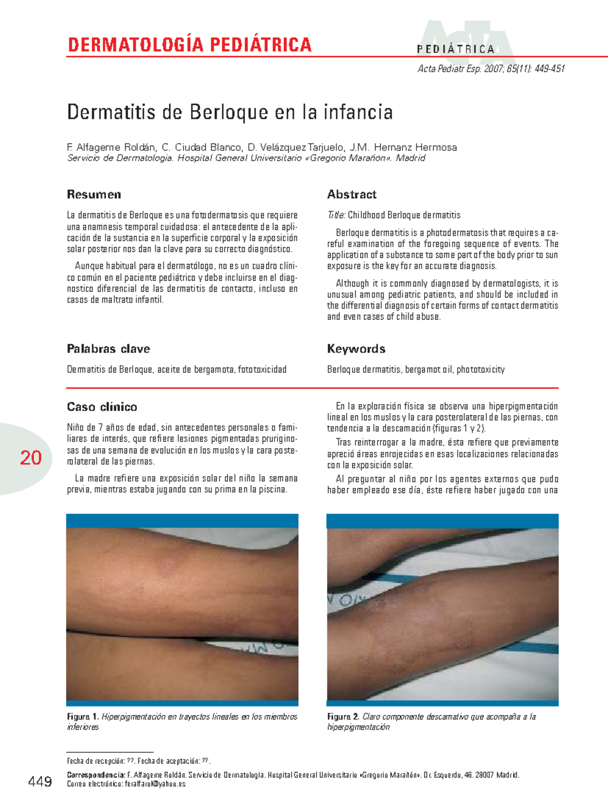 Dermatología Pediátrica: Dermatitis de Berloque en Niños - Acta Pediatr ...