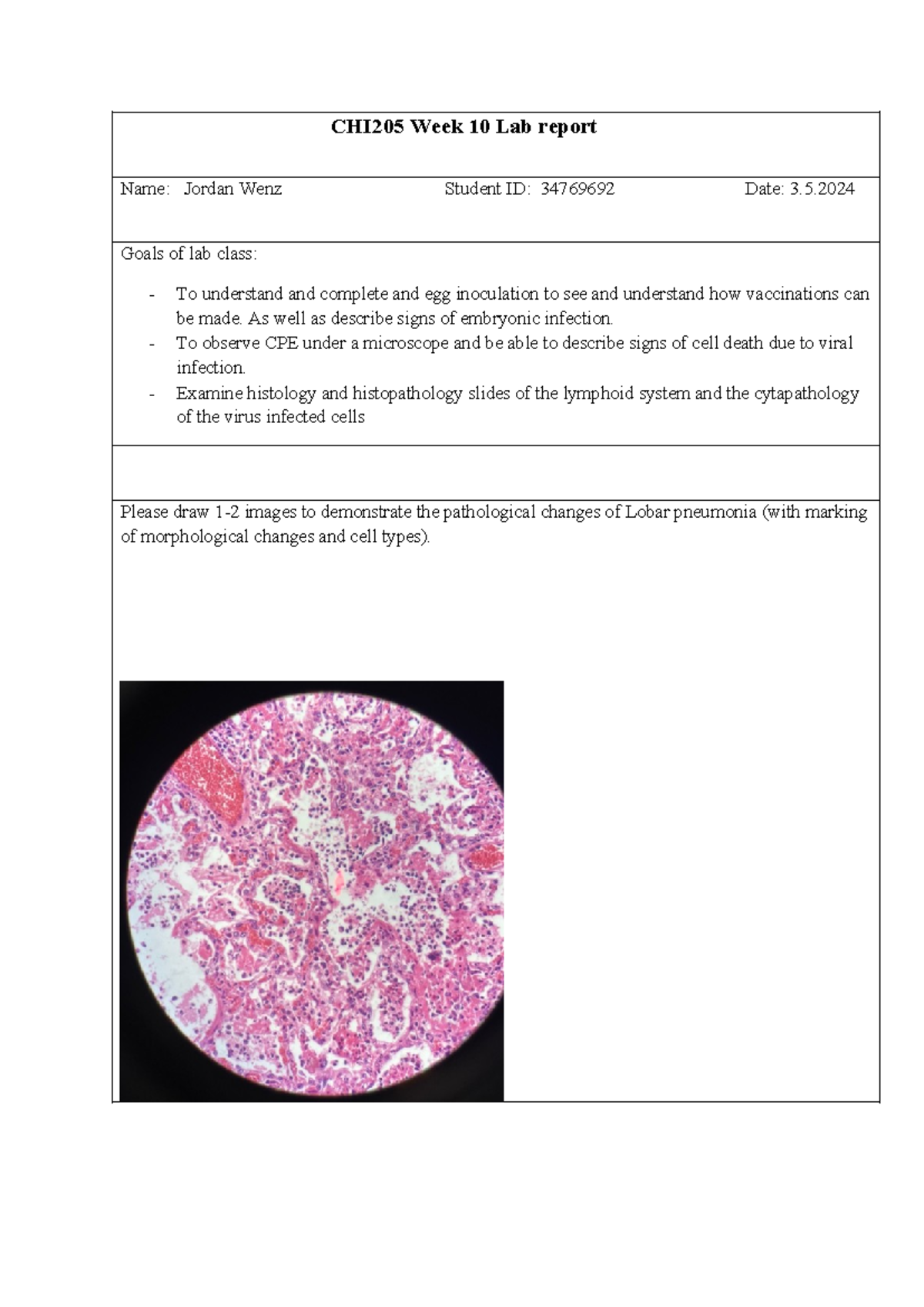 CHI205 Week 10 Lab Report: Egg Inoculation & CPE Analysis - Studocu