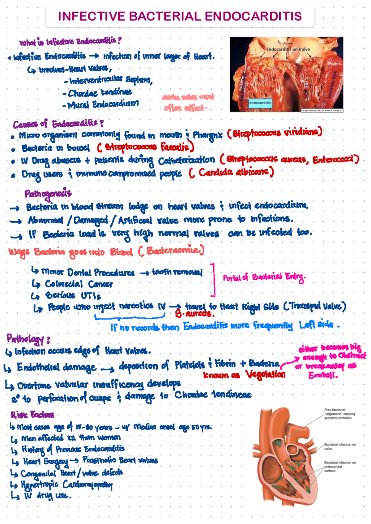 Infective endocarditis Cardiology - ####### INFECTIVE BACTERIAL ...