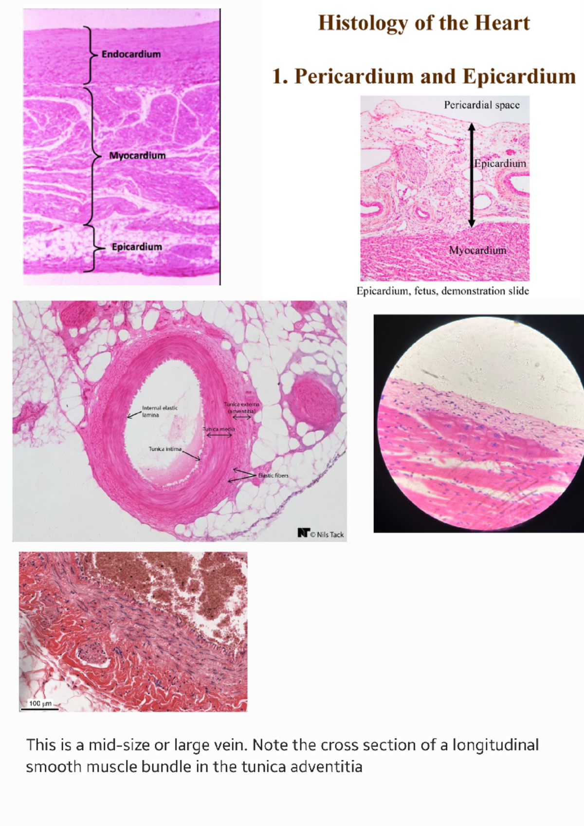 Epicardium Histology Gross Anatomy And Histology Of The Heart