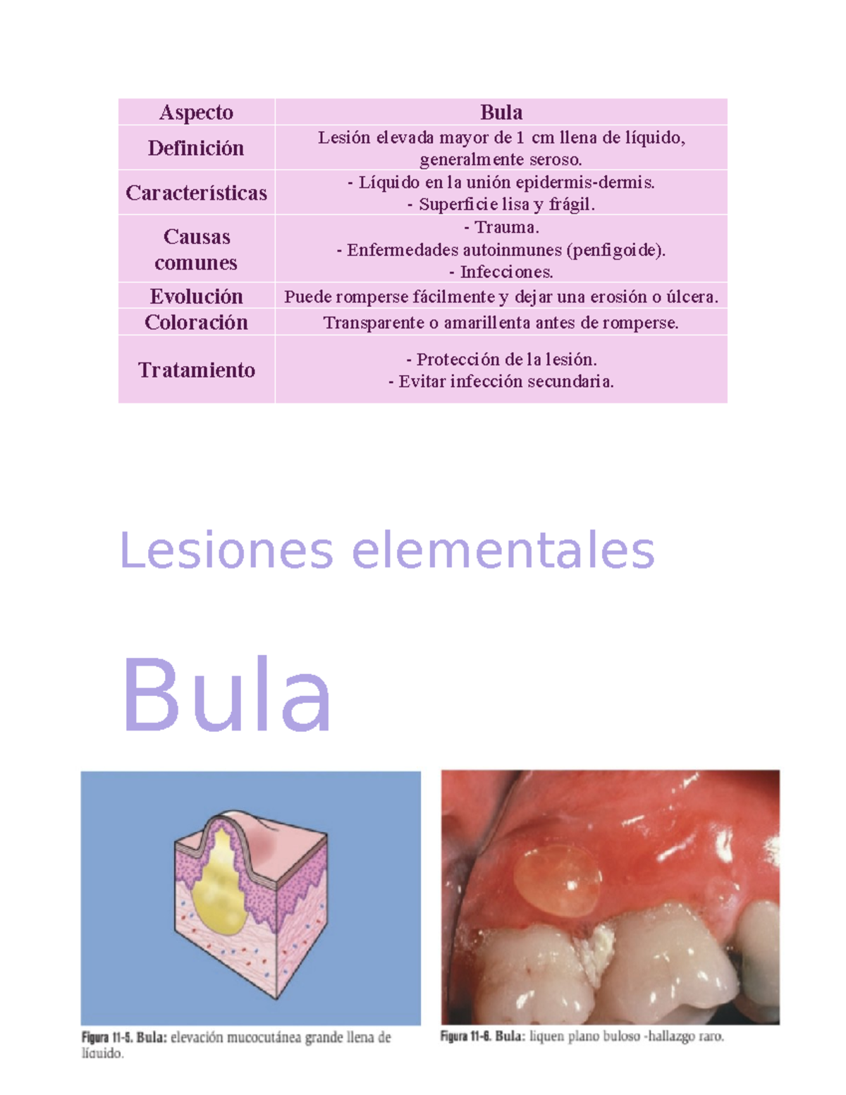 Cuadro bula - patologia bula - Aspecto Bula Definición Lesión elevada ...