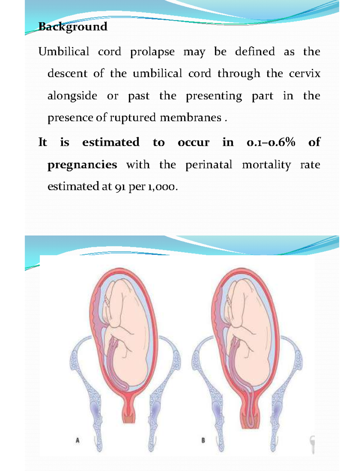 Umbilical Cord Prolapse