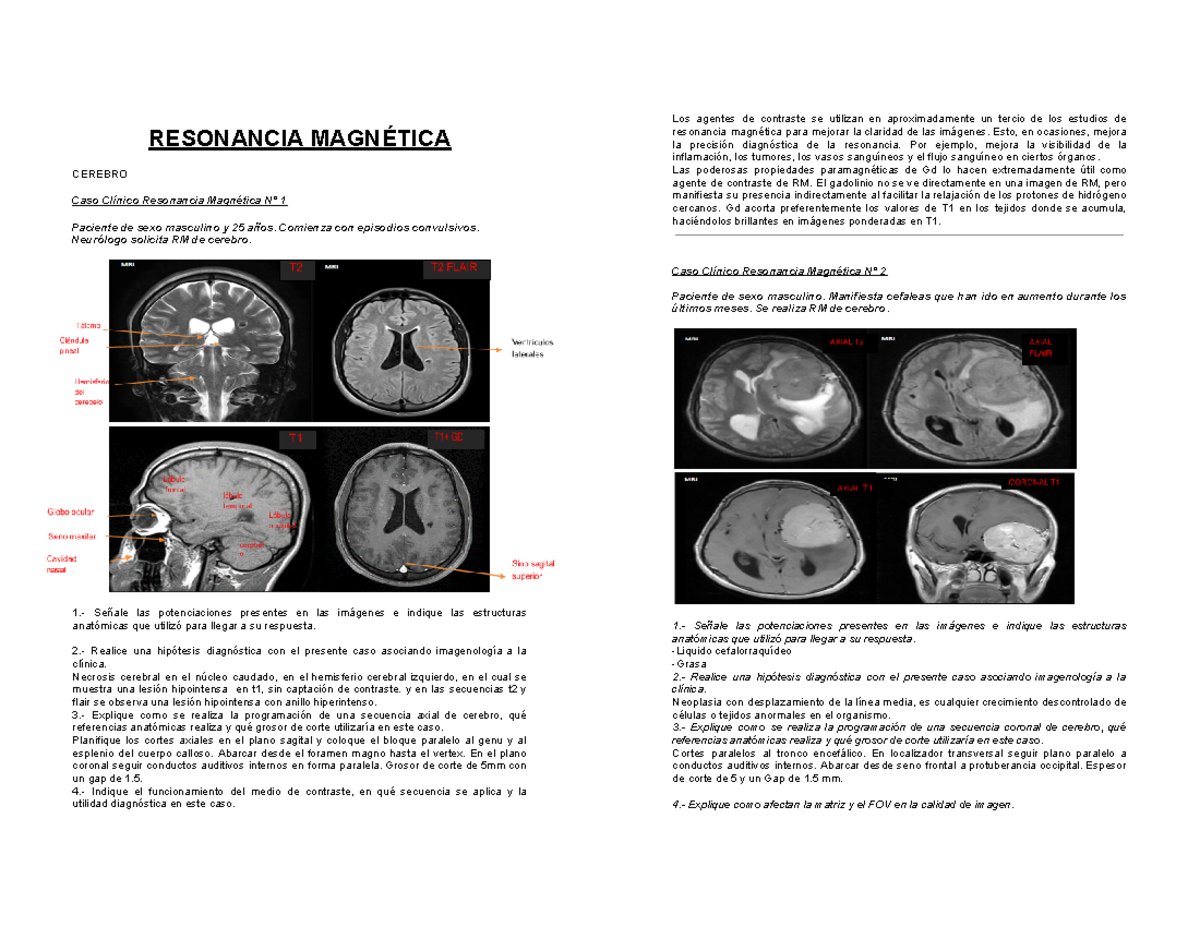 Casos Clínicos de Resonancia Magnética: Diagnóstico y Protocolo RM ...