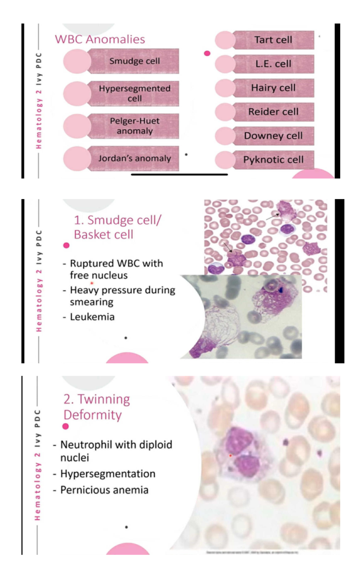 WBC Anomalies and Disorders - Hematology 2 Ivy PDC - Studocu