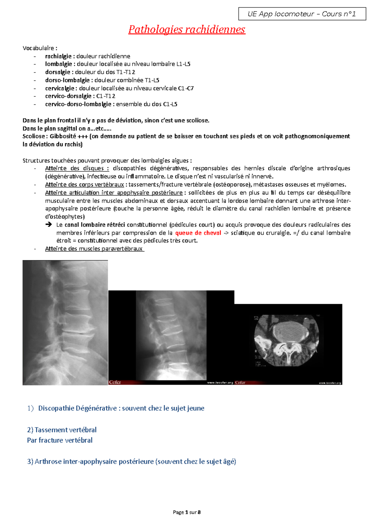 C18 - Pathologie rachidienne - Pathologies rachidiennes Vocabulaire ...