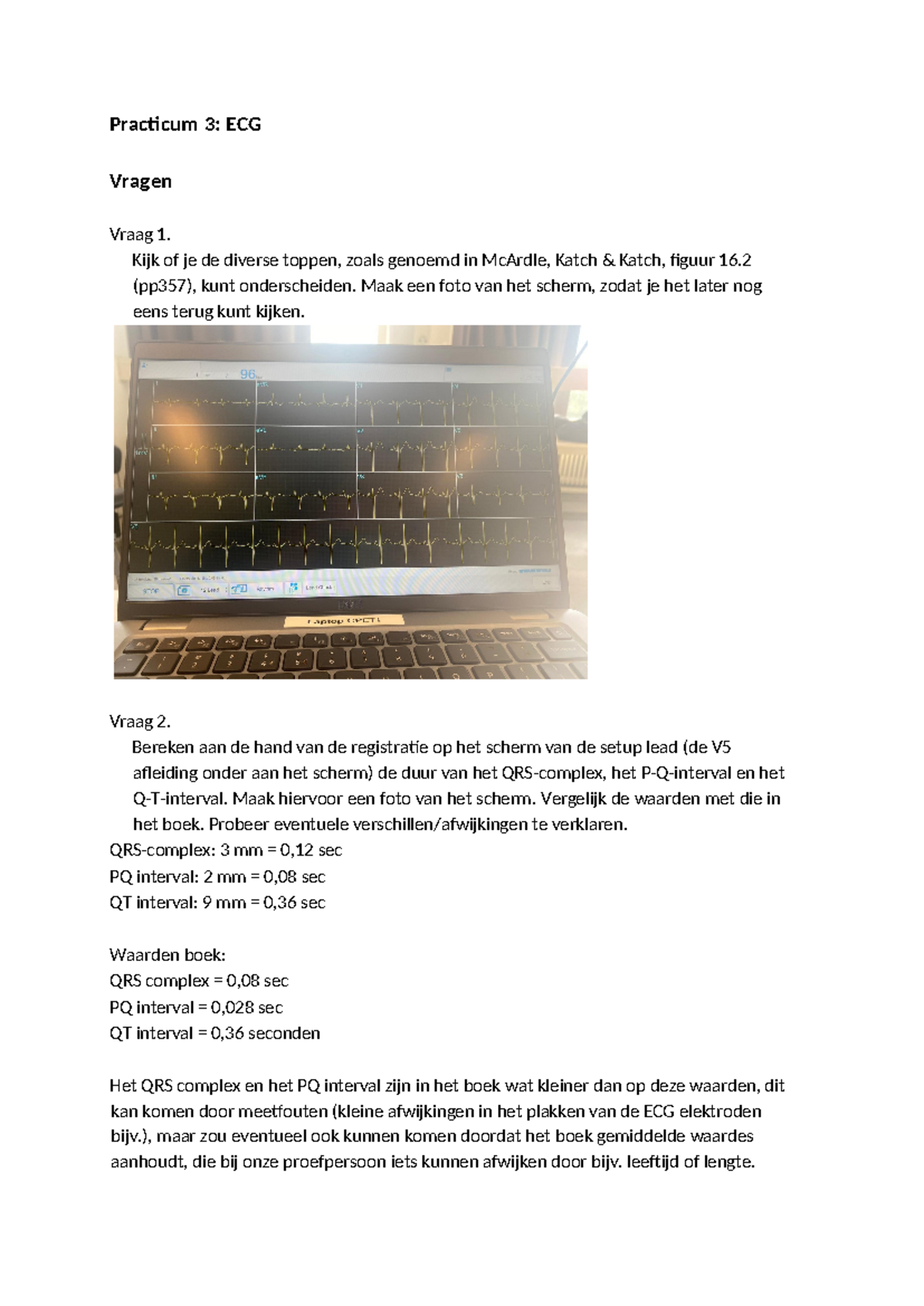 Practicum 3: ECG Analyse en Interpretatie van Hartfrequenties - Studeersnel