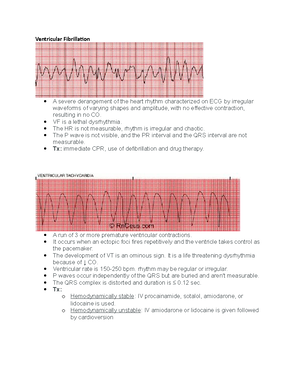 Angina Pectoris Concept Map - ANGINA PECTORIS Pathophysiology ...