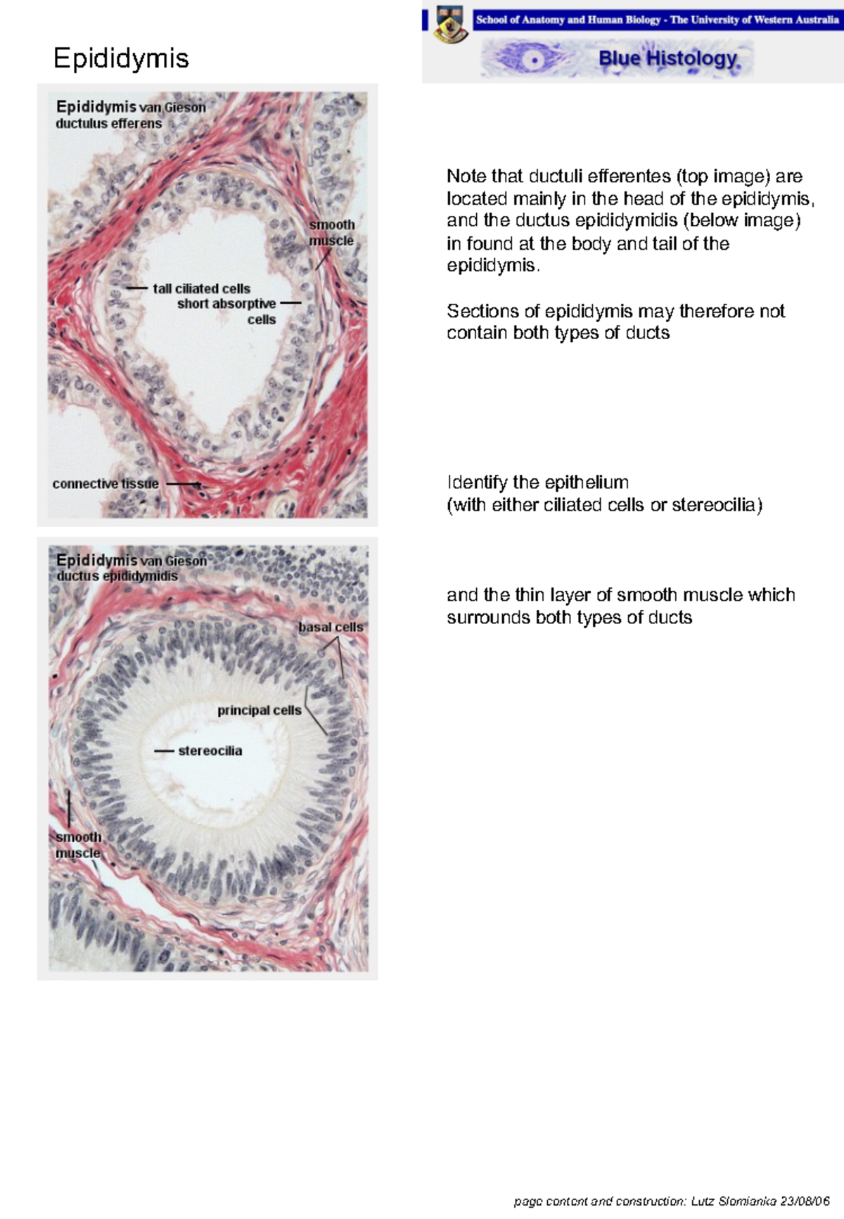 Histology Helper: Epididymis, Vas Deferens, and Prostate Insights - Studocu