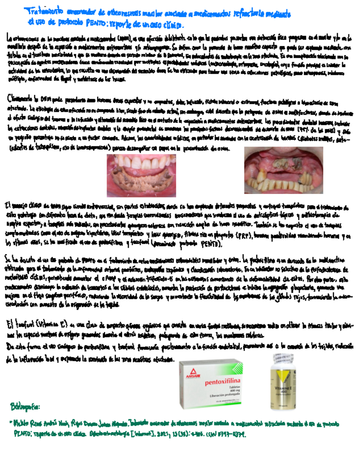Uso del Protocolo PENTO en el Tratamiento de Osteonecrosis Maxilar ...