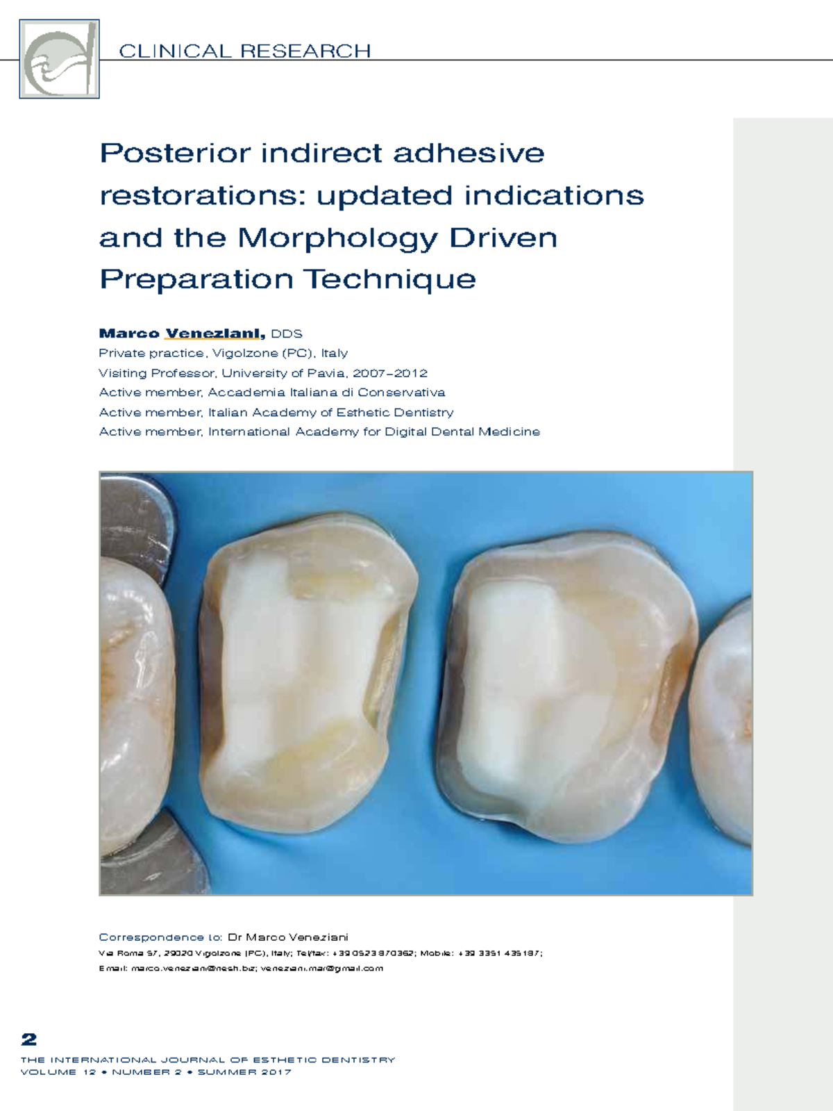 IJEDe 17 02: Updated Indications for Indirect Adhesive Restorations and ...